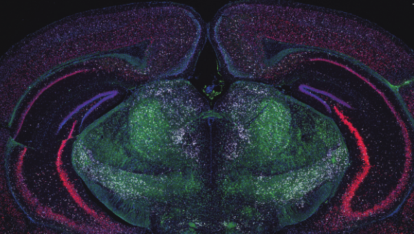 RNAscope Hiplex 验证并解析前脑早期发育过程中基因时空表达特征 - 知乎