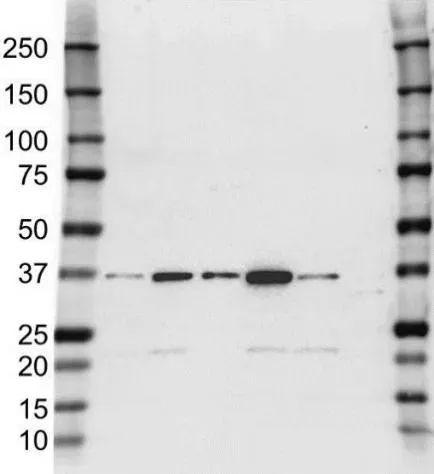 Nature等期刊要求未剪裁的WB图！一张合格的WB图长什么样？ - 知乎