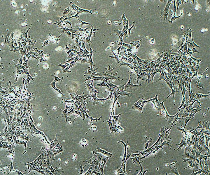 赛库细胞学堂|人体乳腺癌模型---4T1 - 知乎