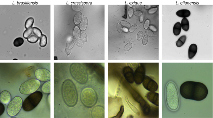 利用深度学习开发葡萄真菌孢子分类的显微镜图像数据集 - 知乎