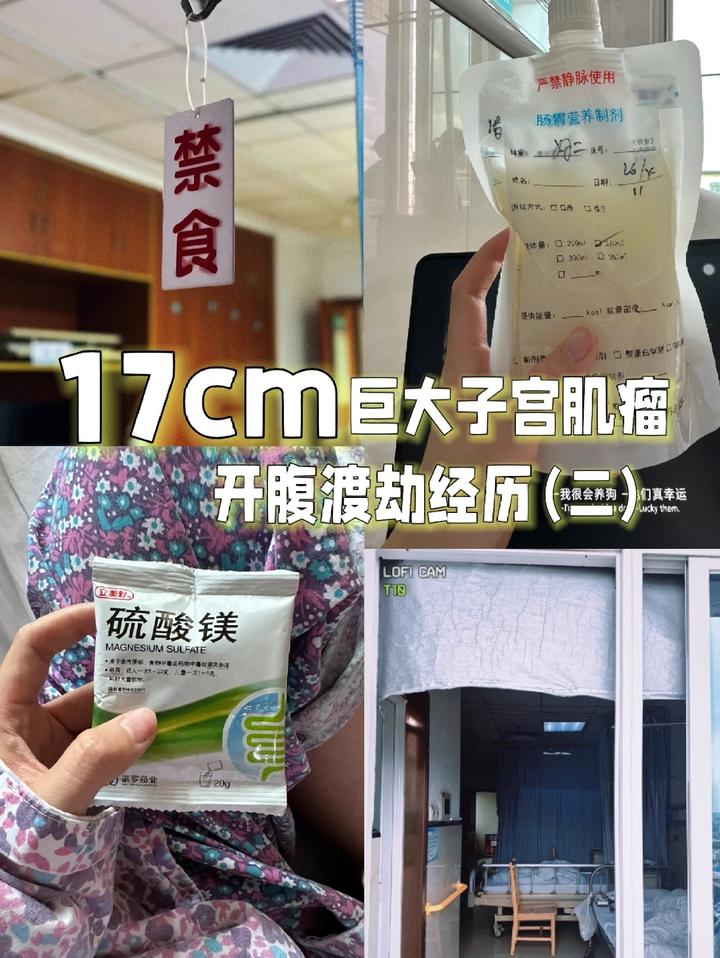 17cm巨大子宫肌瘤开腹经历（二） - 知乎