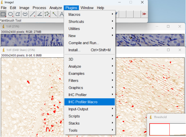 解忧小工具｜保姆式教程！用Image J进行免疫组化分析（IHC score评分） - 知乎