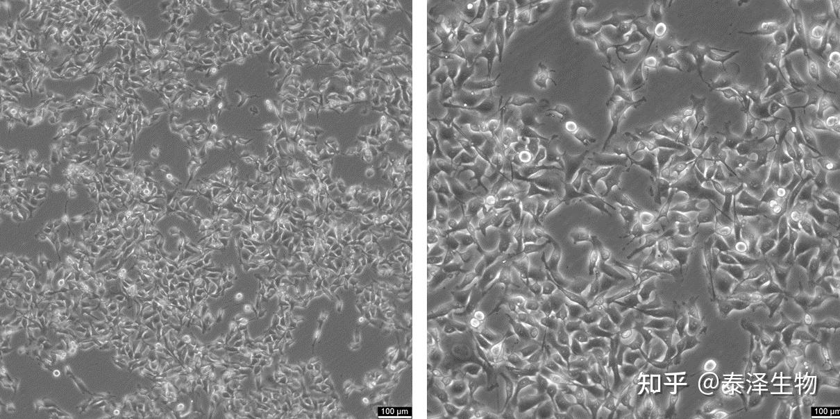 B16细胞加药孵育真的要3天吗? - 知乎