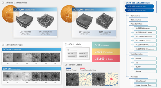 80GB医学影像数据集！OCTA-500公开发布 - 知乎