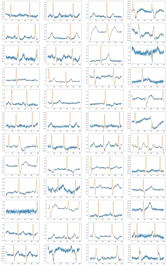 几种心电信号ECG降噪方法（Python） - 知乎
