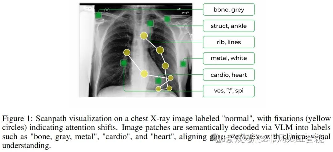 NeurIPS 2025 | 医疗 AI LogitGaze-Med：重新定义医学影像注意力预测 - 知乎