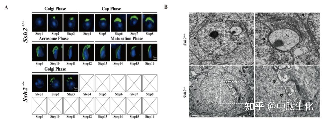 eLife | 陈子江/刘洪彬团队揭示SSH2参与精子顶体形成的新机制 - 知乎