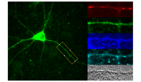 ImageJ实用教程 - 知乎