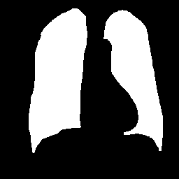 JSRT 肺部X-Ray影像区域识别数据集介绍 - 知乎