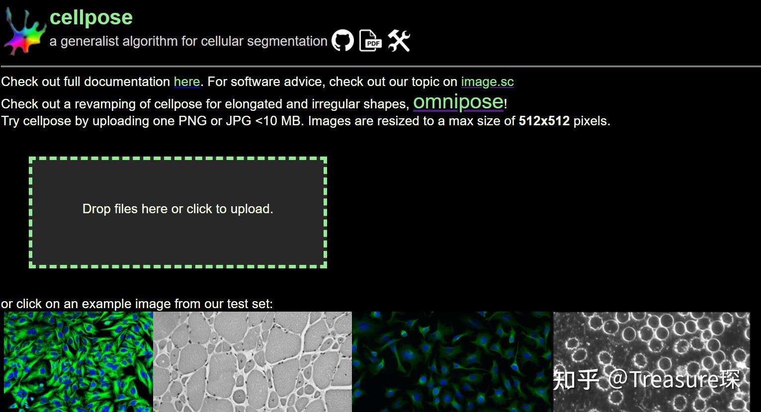 ImageJ实用教程——基于cellpose的不规则细胞分割（案例分析篇） - 知乎