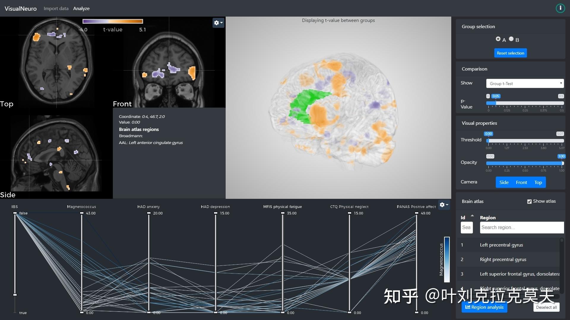 科学可视化软件介绍4 – Inviwo - 知乎