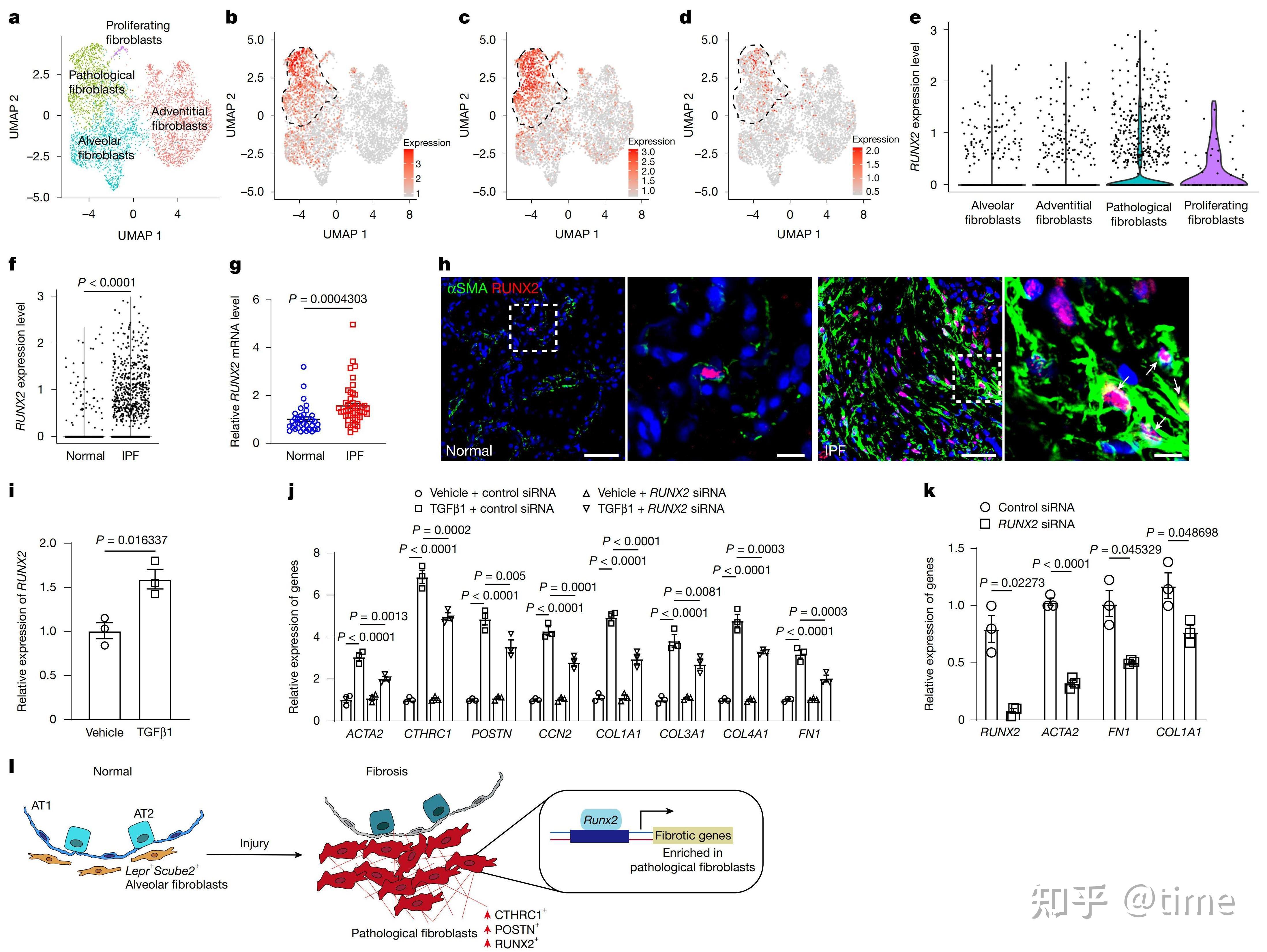 文献分享 | Nature：RUNX2通过肺泡-to-病理性成纤维细胞转化促进纤维化 - 知乎