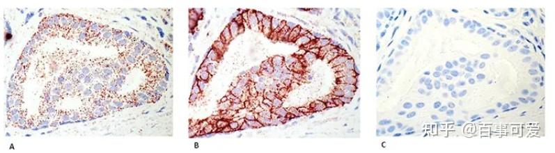 Duolink® PLA明场实验方案 | 默克生命科学分享 - 知乎