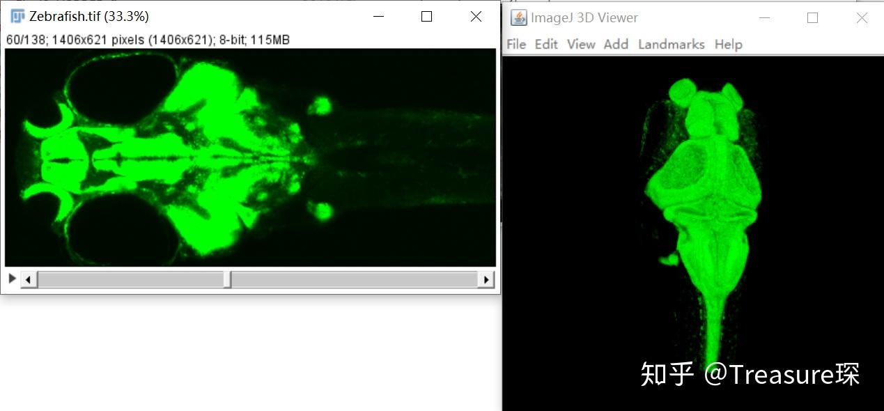 ImageJ实用技巧——3D渲染动画(插件篇) - 知乎