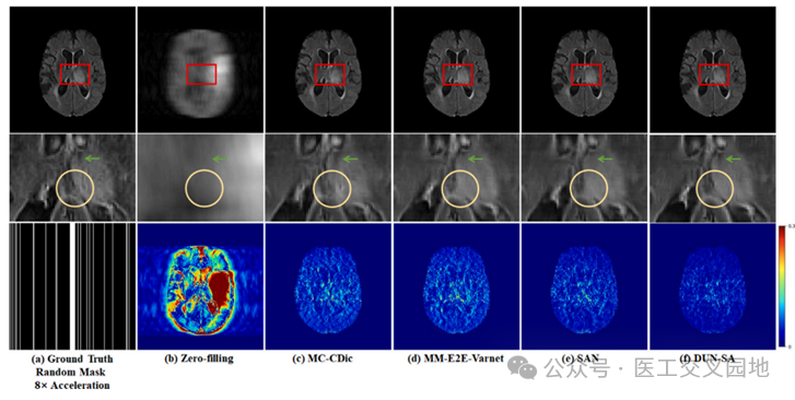 上海大学的应时辉教授提出基于空间对齐的MRI多模态重构深度展开网络 - 知乎