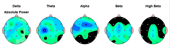 神经反馈训练（NFB）是什么？ - 知乎