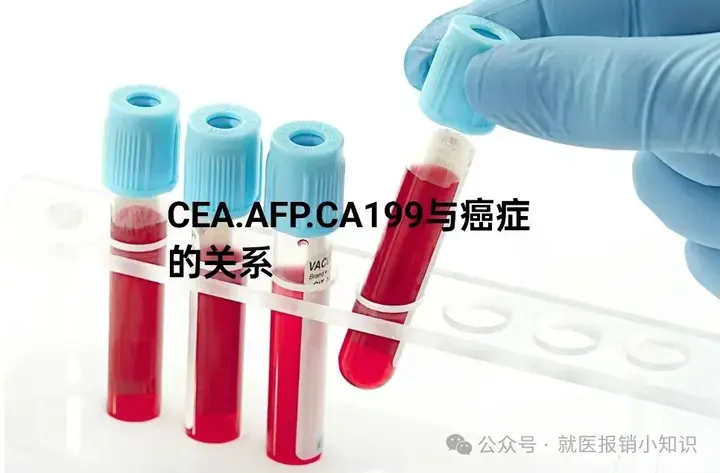 CEA、AFP、CA199、CA125、CA724与癌症的关系 - 知乎
