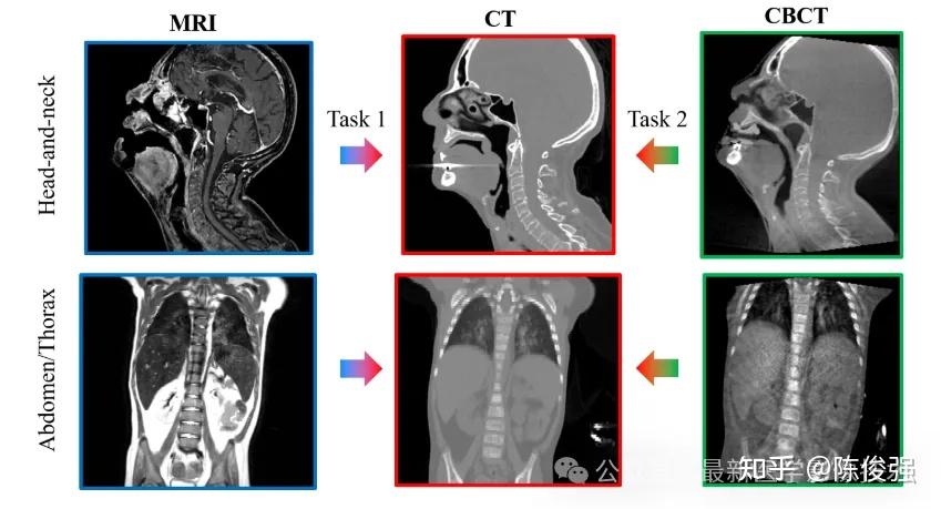 SynthRAD2025——用于放射治疗的计算机断层扫描生成挑战赛 - 知乎