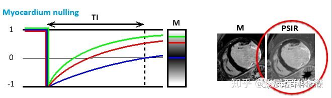 如何进行心脏黑血LGE？ - 知乎