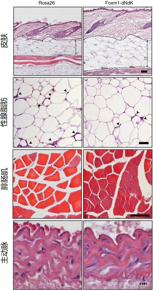 抗衰老研究的新靶点——FOXM1 - 知乎