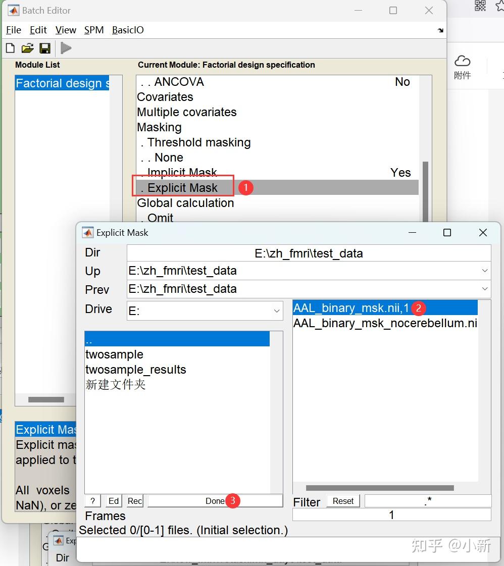 10-SPM-fmri任务态 二阶分析： 配对样本t检验 - 知乎