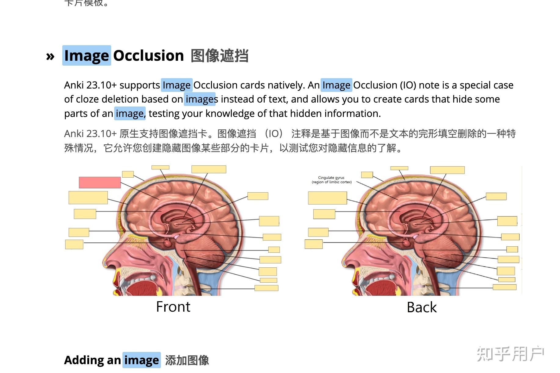 Anki 插件 image occlusion 如何将多处覆盖作为一组，一次翻面一组中的覆盖全部出现？ - 知乎