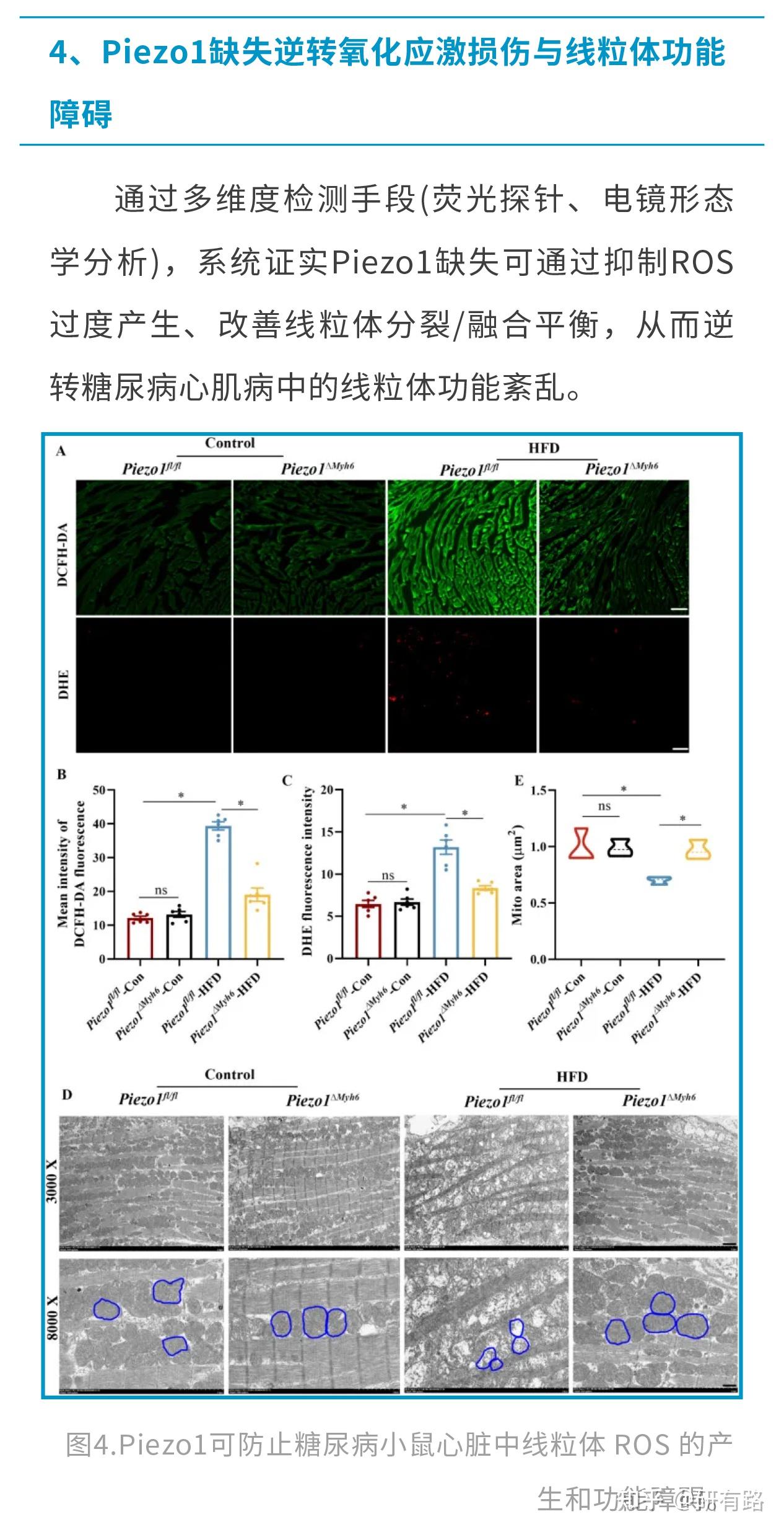 Piezo1喜登双科顶刊！"表型+分子+机制+干预"，山东中医药大学首揭Piezo1通过线粒体动态调控改善糖尿病心肌病~ - 知乎