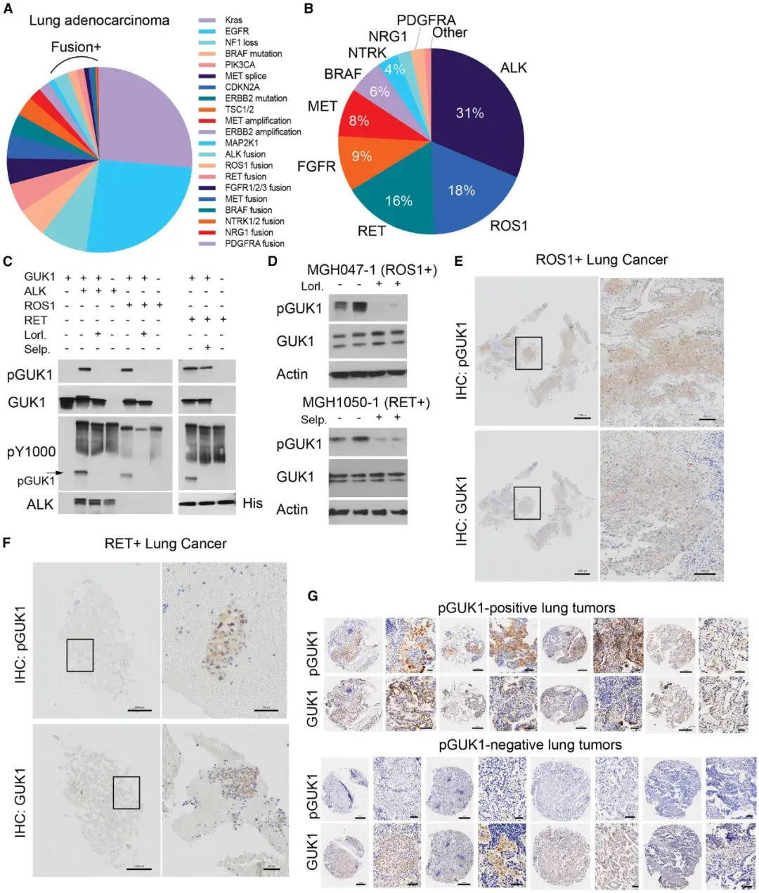 Cell重磅 | 酪氨酸磷酸化组学鉴定GUK1为肺癌关键的代谢调控靶点 - 知乎