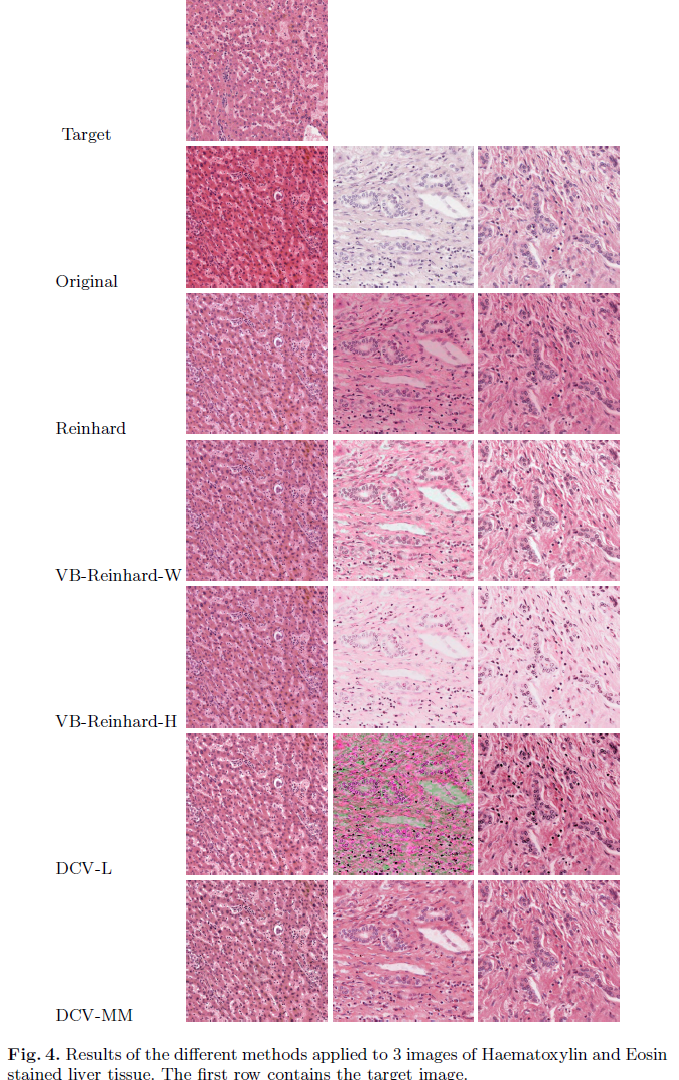 Colour Normalisation in Digital Histopathology Img - 知乎