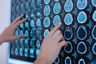 论文如何发表:BMC NEUROLOGY - 知乎