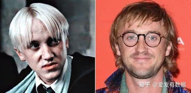 为什么欧美人脱发的比率要其他的国家要高？ - 知乎