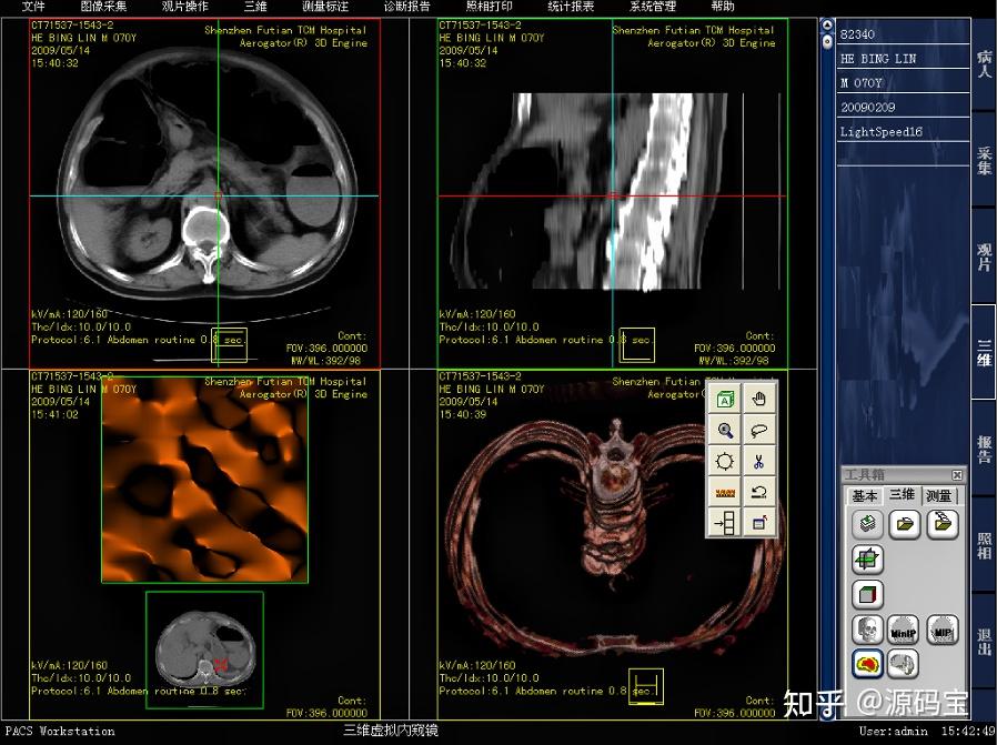 医院的HIS、CIS、LIS、EMR、PACS、RIS、CAD都是指哪些系统，谢谢，请分别回答?? - 知乎