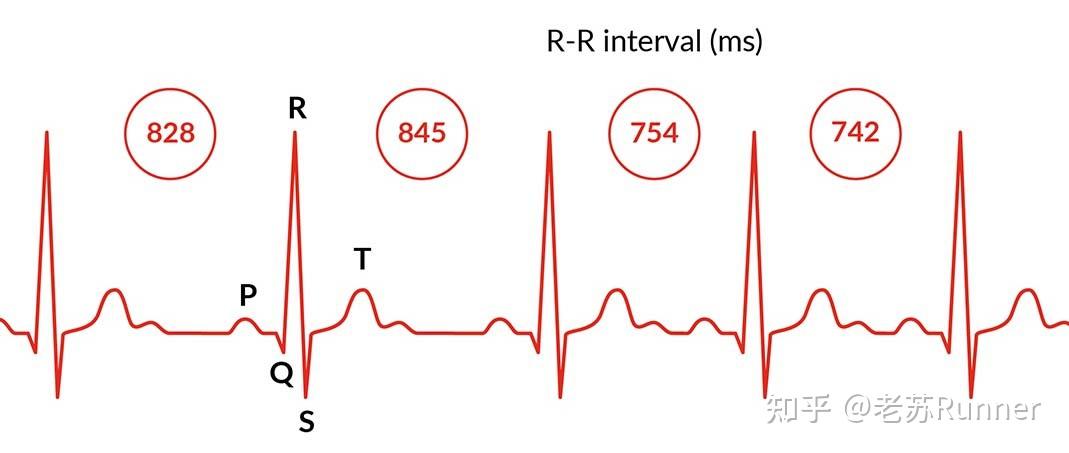 了解佳明Garmin 设备上HRV状态 - 知乎