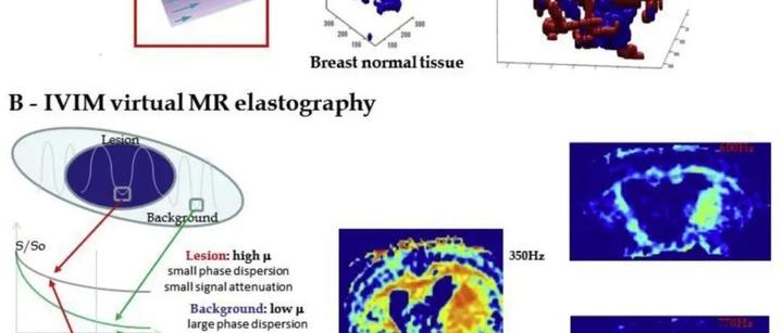 通过IVIM 磁共振成像，我们能看到什么（7） - 知乎