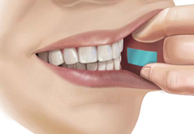 Libervant口腔膜剂获批用于治疗2至5岁患者的丛集性癫痫发作 - 知乎