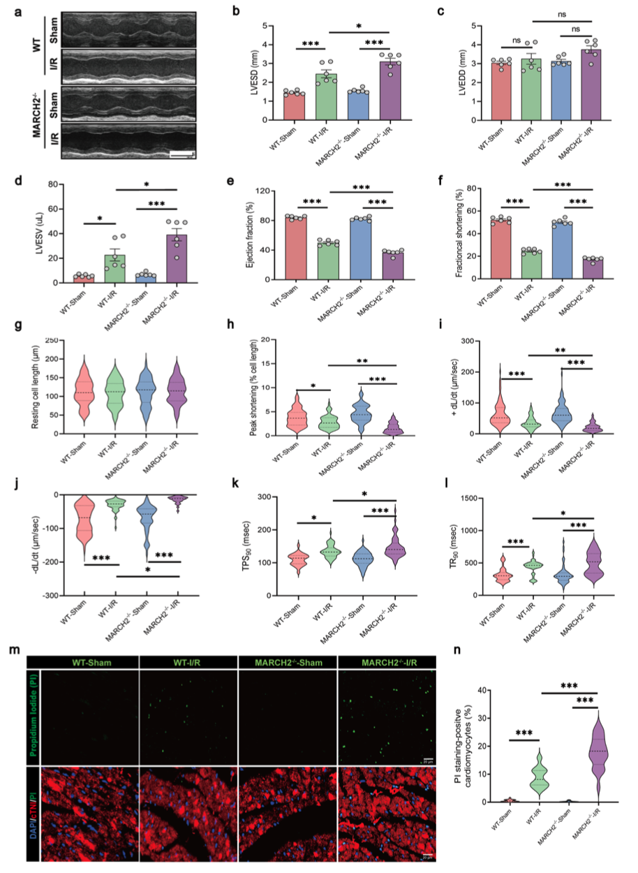 Cell Discovery丨IF：33.5丨MARCH2通过抑制焦亡从而保护心肌缺血再灌注损伤 - 知乎