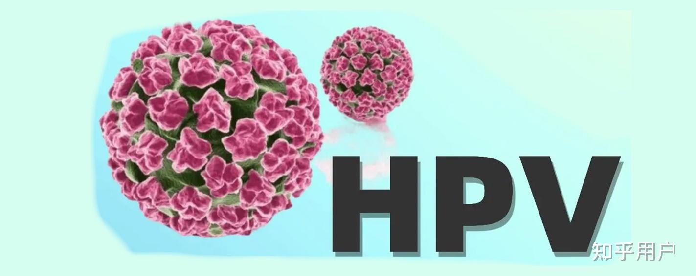 感染HPV多久会发展成cin1? - 知乎