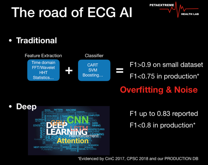 回首向来萧瑟处：ECG AI之路 - 知乎