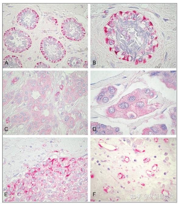 SCI写作-利用NCBI下的网页OPENI进行图片检索，制作高大上的流程图，反向检索文献 - 知乎