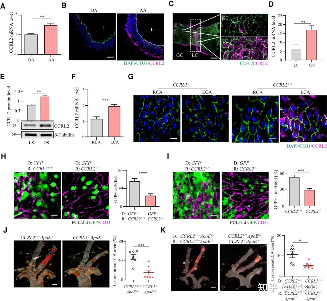 Cardiovasc Res | 10x单细胞揭示CCRL2在动脉粥样硬化发展中的作用 - 知乎