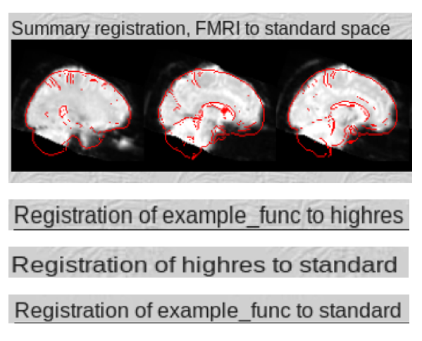 有没有一套比较成熟的fMRI数据质量检查体系？ - 知乎