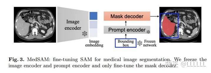 SAMed:Customized Segment Anything Model for Medical Image Segmentation - 知乎