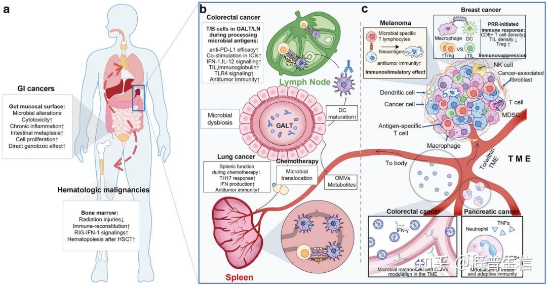 肠道微生物群在抗癌治疗中的作用 - 知乎