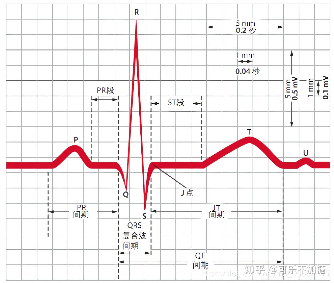 基于深度学习的ECG心律失常分类（图解完整版附代码） - 知乎