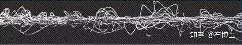 常常说的“ATY”究竟是什么？ - 知乎