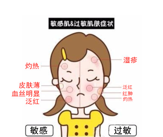 一张图让你分清敏感肌和皮肤过敏 知乎