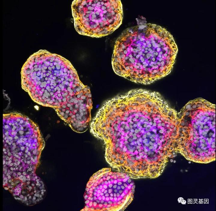 Nat Comm | 类器官和CRISPR-Cas9为罕见肝癌提供新见解 - 知乎