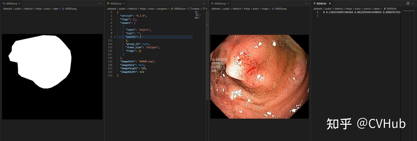 AI标注神器 X-AnyLabeling-v2.3.0 发布！支持YOLOv8旋转目标检测、EdgeSAM、RTMO等热门模型！ - 知乎