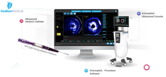 主流RDN企业产品研发进度 - 知乎