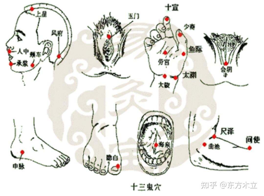鬼门十三针真的那么神奇吗？ - 知乎